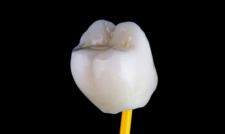 A Guide to Address Tooth Sensitivity With Dental Crowns