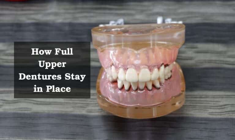 How Do Full Upper Dentures Stay in Place?
