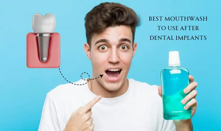 What is the Best Mouthwash to Use After Dental Implants?