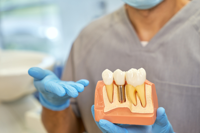 Can You Get an MRI With Dental Implants? What You Should Know